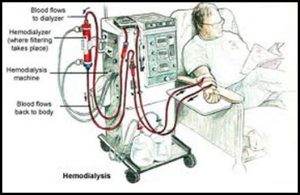 Dialysis