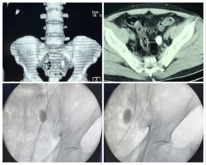 Gallery - UroCare Chennai