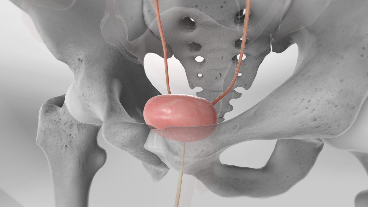 Radical Cystectomy: A Comprehensive Overview – UroCare Chennai